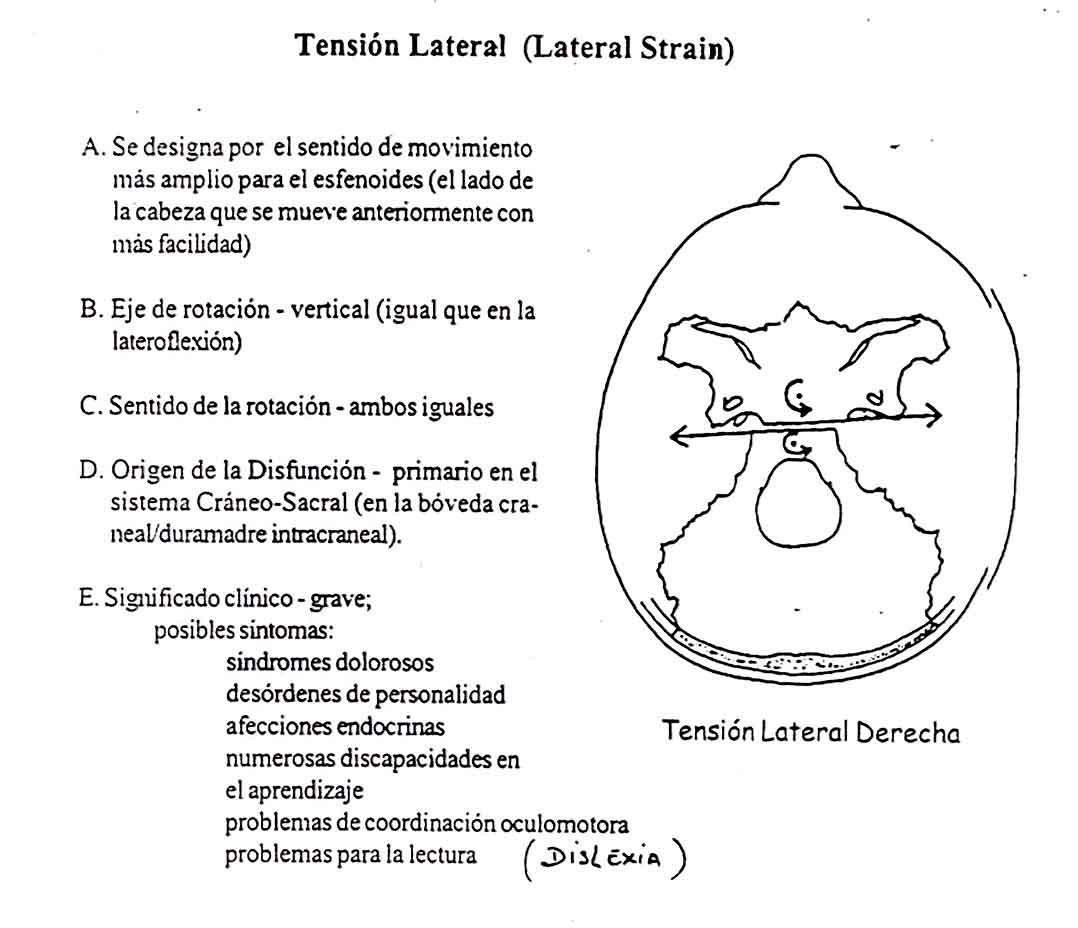 16- Sincondrosis esfenobasilar - www.SacroCráneo.es